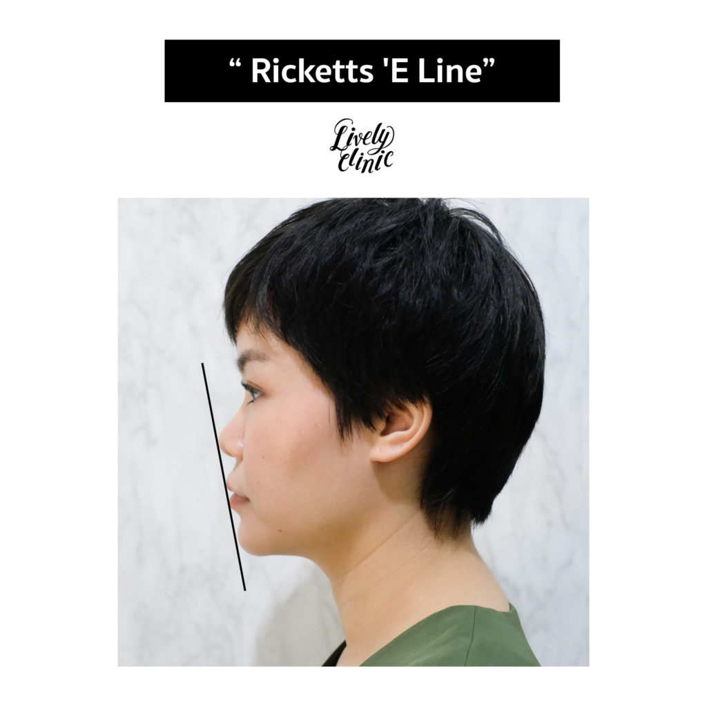 ปรับรูปหน้าคืออะไร - Lively Clinic